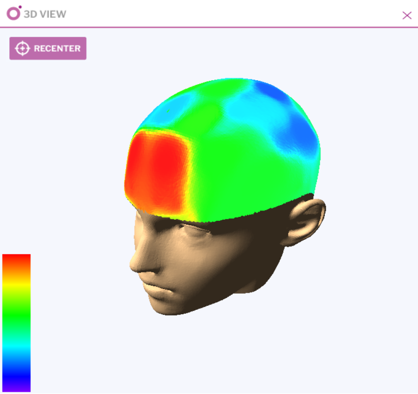 What does the scalp topography on the 3D head model represent?